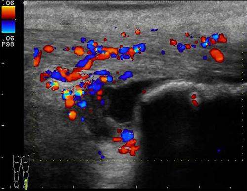 Läkarhuset i Östersund www.min-doktor.com - Ultraljudsscanning